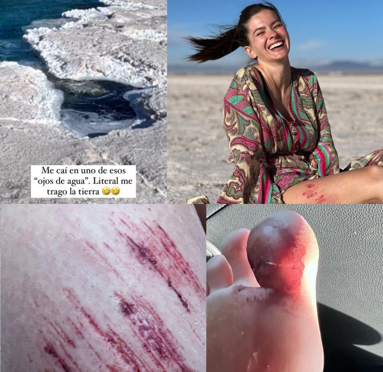 El Terrible Accidente Que Sufrió La China Suárez En Jujuy