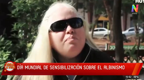 Día de la sensibilización sobre el albinismo: la palabra de quienes ...